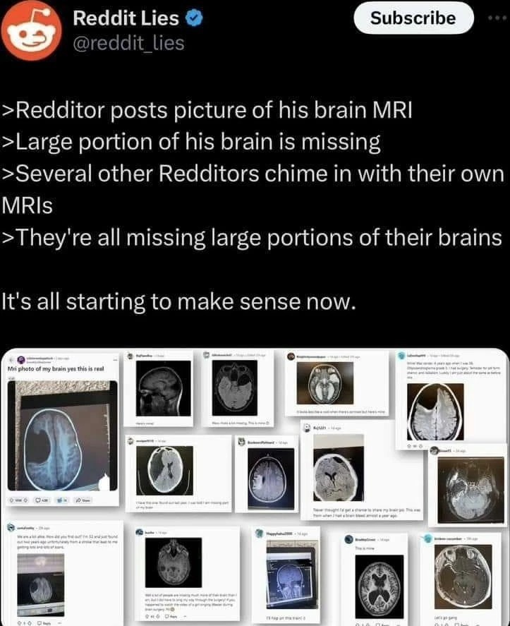 The best Brain memes :) Memedroid