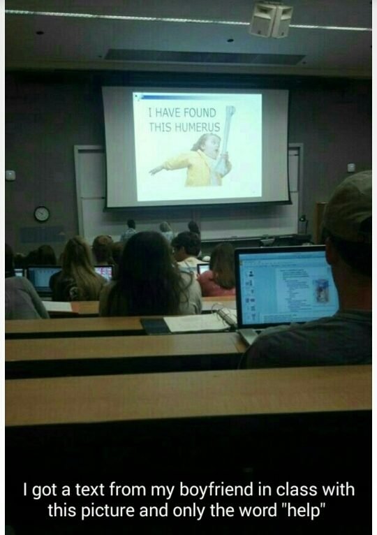 humerus - Meme by farhan2680 :) Memedroid