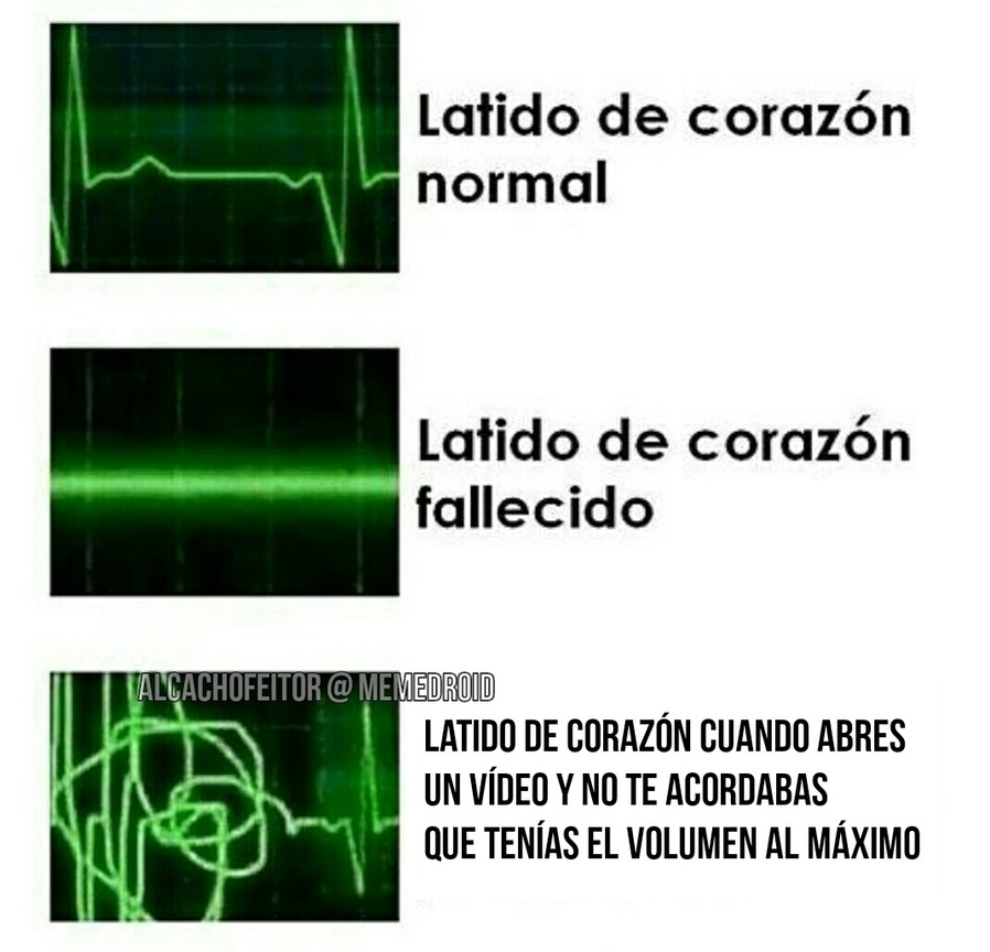 Esos semi-infartos :( - Meme subido por Alcachofeitor :) Memedroid