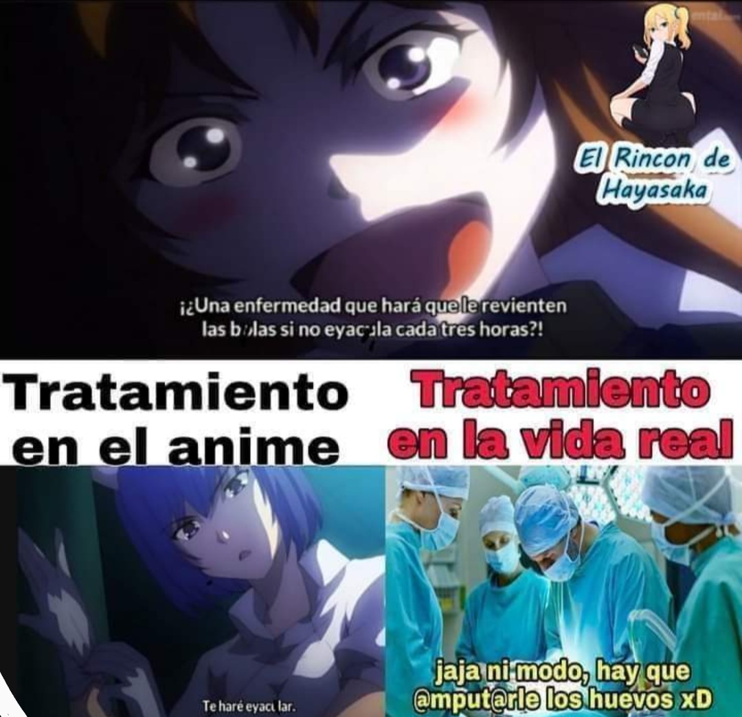 Top memes de Amputación en español :) Memedroid