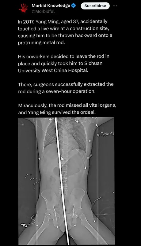 The best Miracle memes :) Memedroid