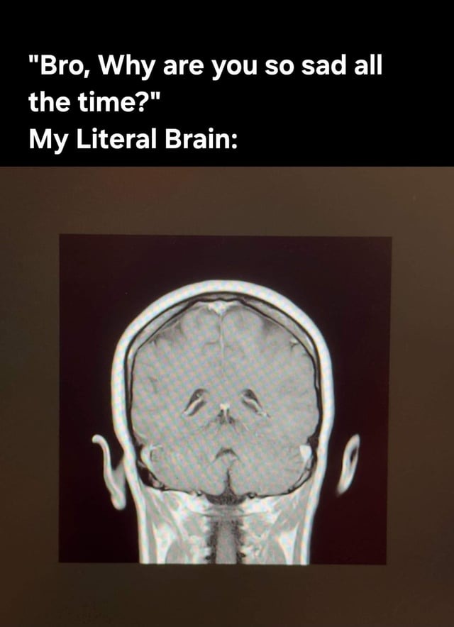 The best Brain memes :) Memedroid
