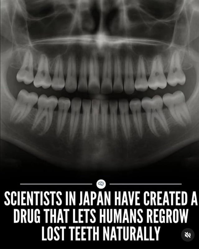 The best Teeth memes :) Memedroid